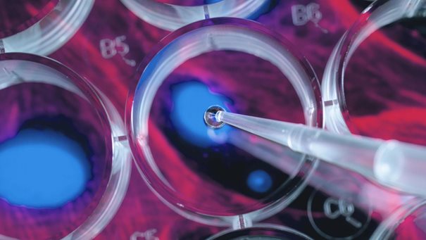 Innovation in viral-vector gene therapy: unlocking the promise | McKinsey